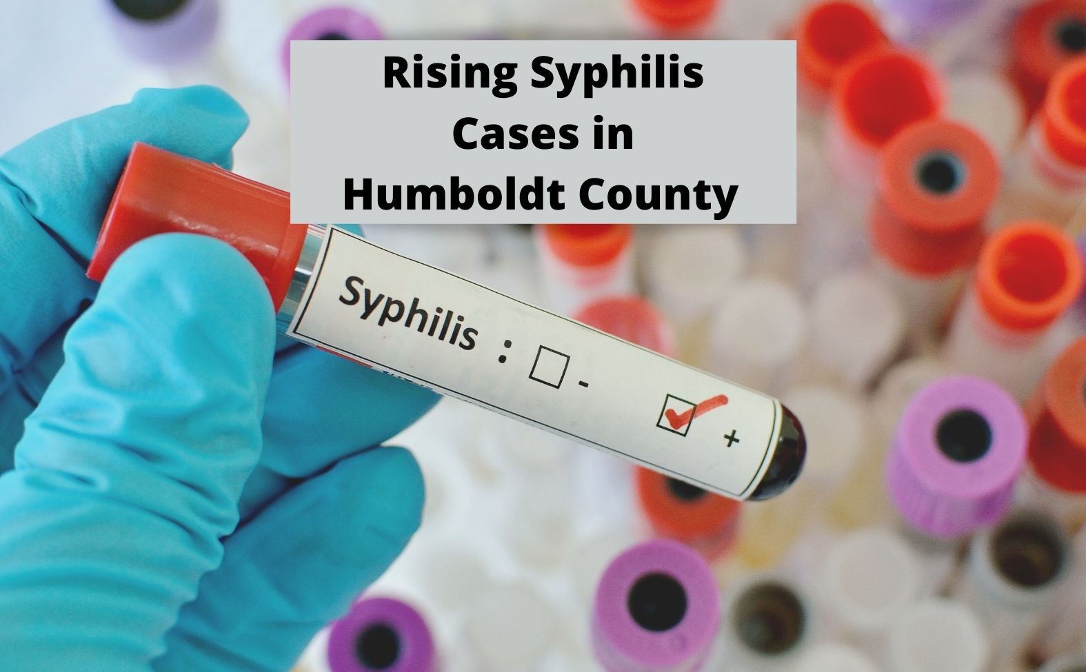 What is Syphilis? Rising Cases in Humboldt County | El Leñador ... What is Syphilis? Rising Cases in Humboldt County | El Leñador ...